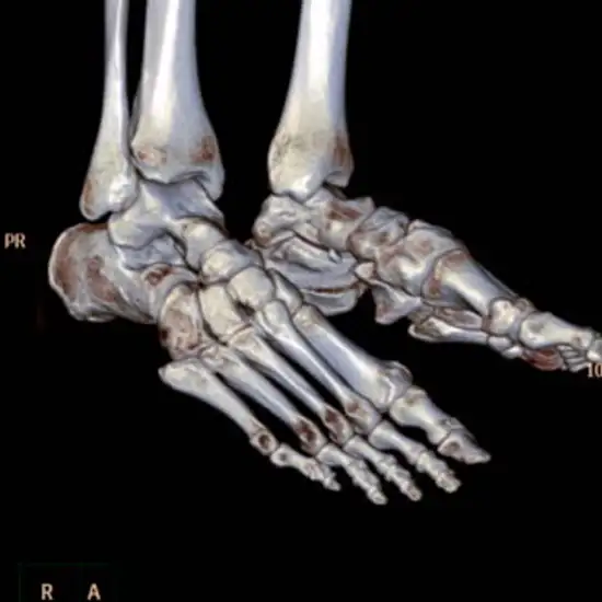 3D CT Both Foot | Medifyhome