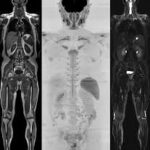 MRI Whole Body Screening | Affordable price | Medifyhome