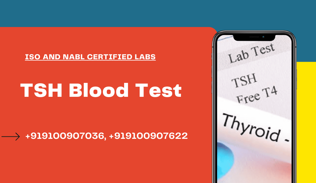 TSH blood test at Home | @Rs 299 | Medifyhome