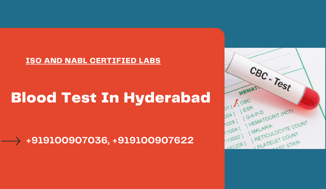 Blood Test at Home in Hyderabad | Lab Test Near Me | MedifyHome