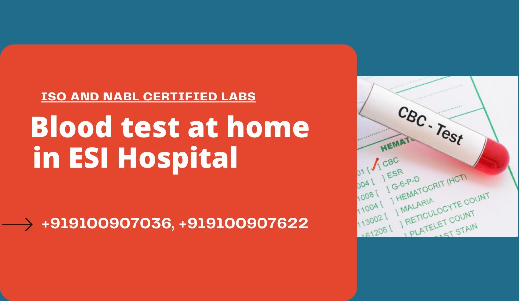 Blood Test at Home in ESI Hospital | Sample Test | Medifyhome