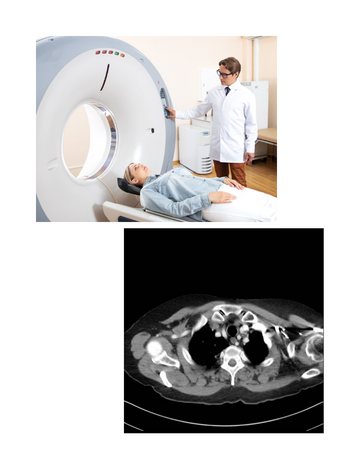 CT scan for sternoclavicular joints | Medifyhome