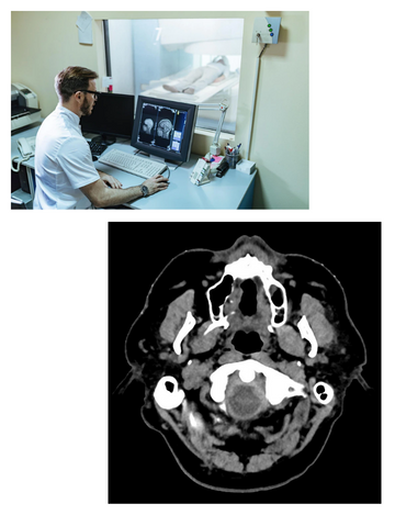 CT scan for sialography | Medifyhome