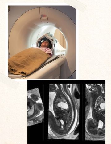 MRI Scan for Fetus | MRI Scan in Hyderabad | Medifyhome