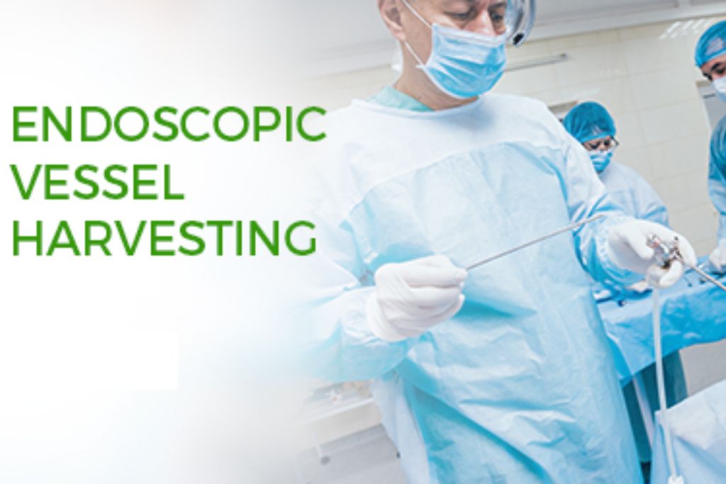 Endoscopic Vessel Harvesting ( EVH ) | Vein Surgery | Medintu