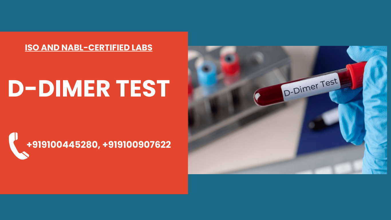 D-Dimer Test in Vijayawada | Starting @799 Only | Medintu