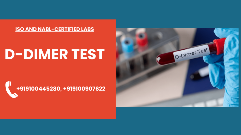 D Dimer Test in Mysore | Starting @699 Only | Medifyhome