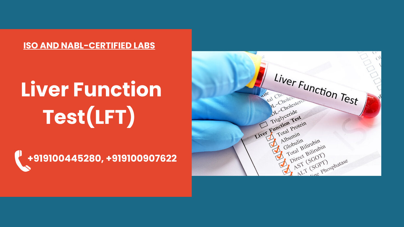 LFT Test in Mysore | Starting @349/- | Medifyhome