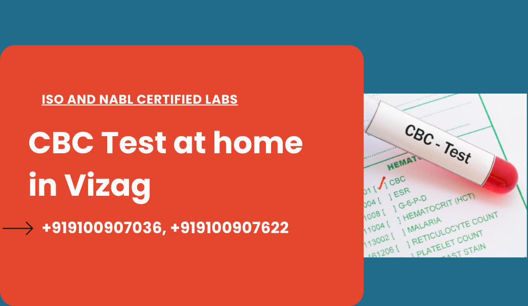 CBC Test Cost in Vizag | Medifyhome