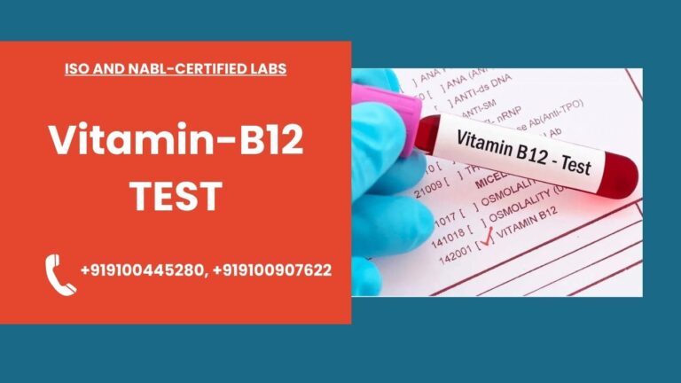 Vitamin B-12 Test Cost in Chennai | Price Starts @399/- | MedifyHome
