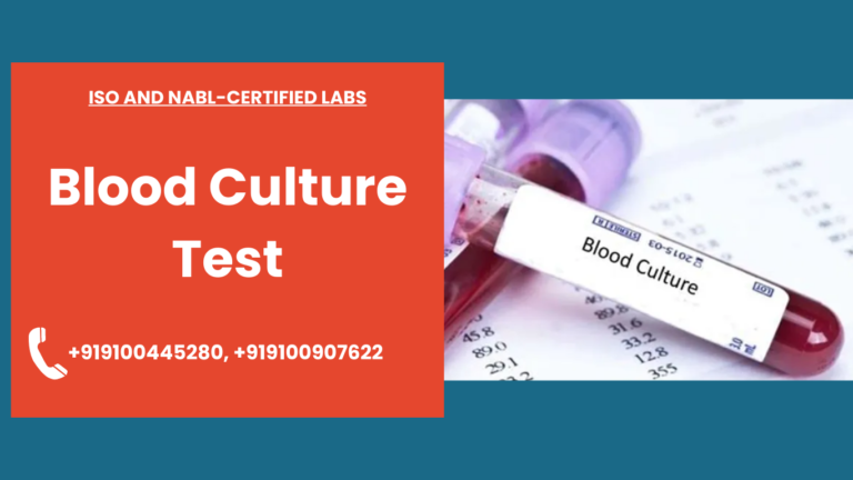 Blood Culture Test in Mysore | Price Starts@379/- | Medifyhome