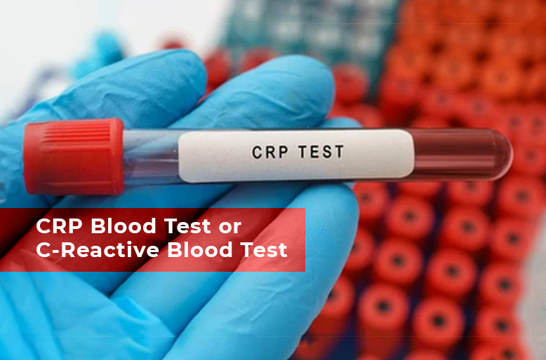 CRP Test at Home | Price Starts @Rs.200 | Medifyhome