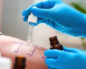 RAST Test at Home | Starts @ Rs.150 | Medifyhome