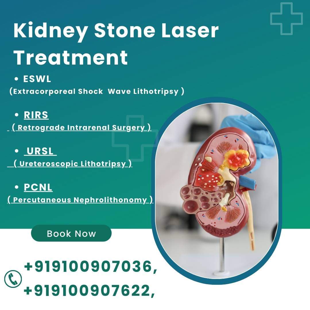 Kidney Stone Laser Treatment | Medifyhome