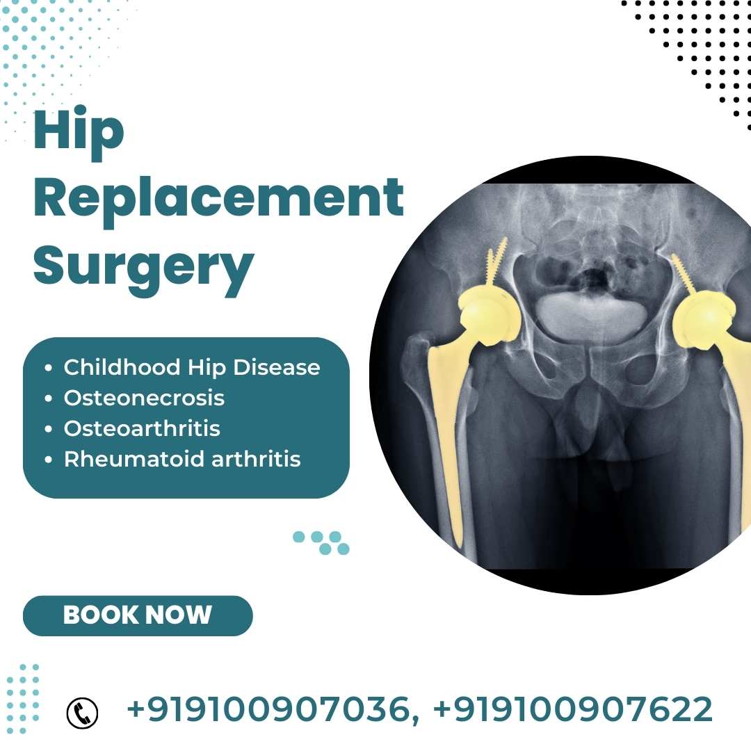 Hip Replacement Surgery | Medifyhome