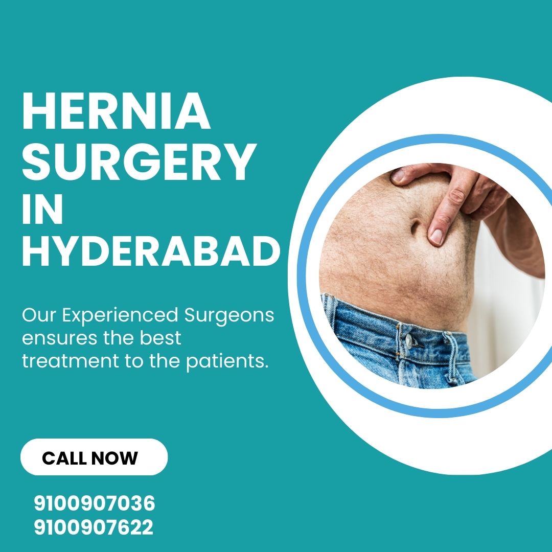 Hernia surgery in Hyderabad | Medifyhome