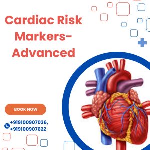 Cardiac Risk Markers- Advanced | Medifyhome