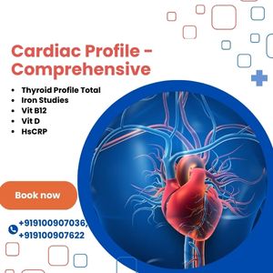Cardiac Profile - Comprehensive | Medifyhome