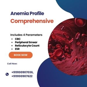 Anemia Profile - Comprehensive | Medifyhome