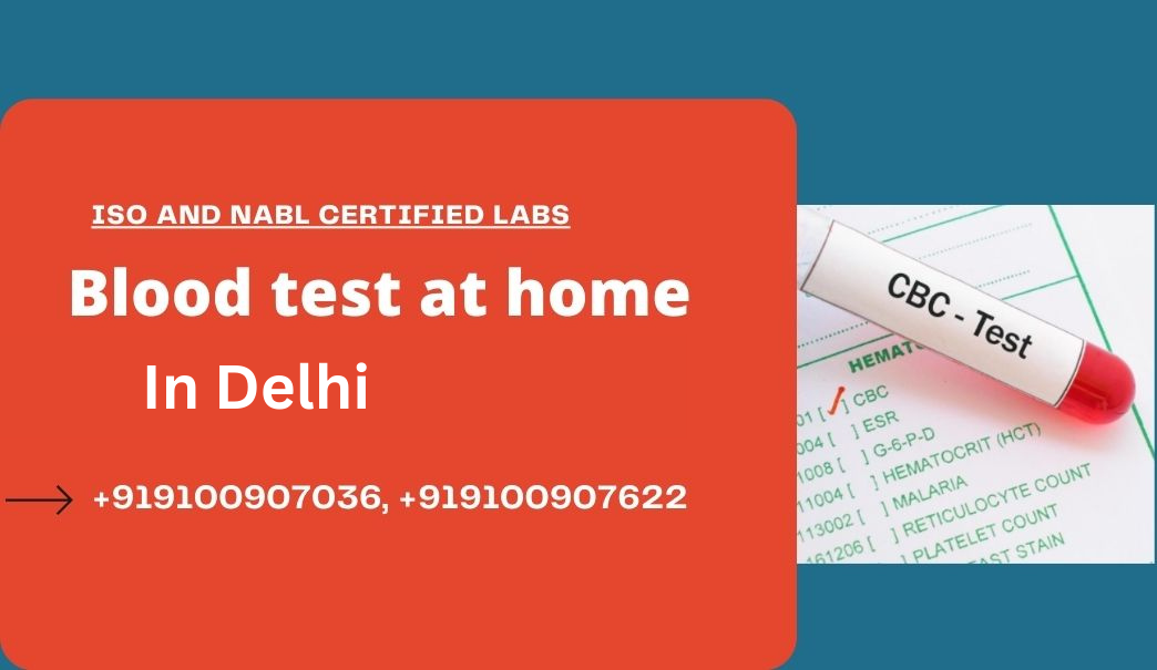 Blood test at home in Badarpur | Medifyhome