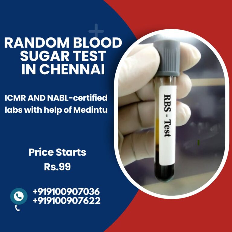 Random Blood Sugar Test in Chennai | Medifyhome