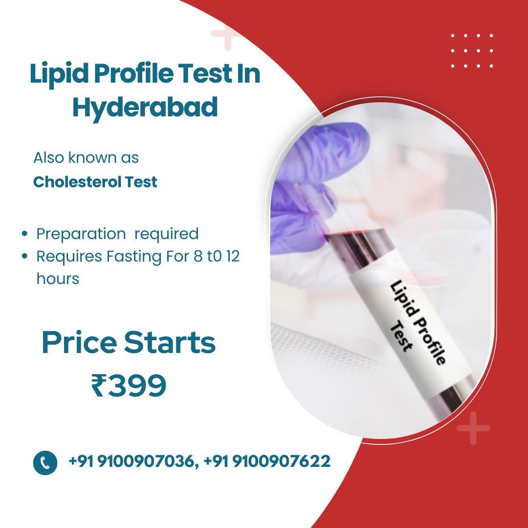 Lipid Profile Test at home in Hyderabad | @Rs.399 | Medifyhome