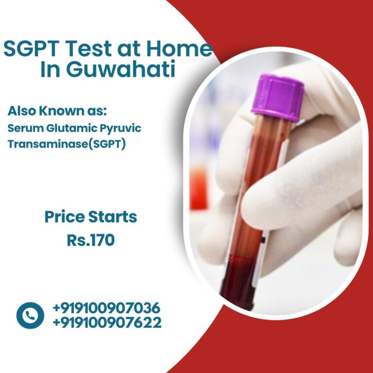 SGPT Test in Guwahati | Medifyhome