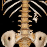 3D CT KUB scan | Medifyhome