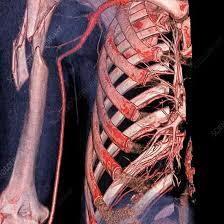3D CT Right Arm | Medifyhome