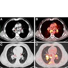 CECT For Axilla | Medifyhome