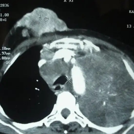 CECT Lower Chest | Medifyhome
