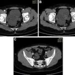 CECT Pelvis | Medifyhome