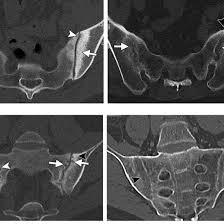 CECT SI Joints | Medifyhome