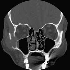 CT Head and Face | Medifyhome