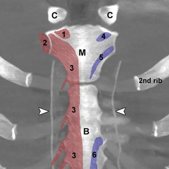 CT scan for sternum | Medifyhome