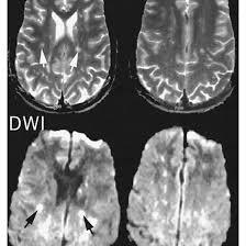 MRI Scan For MR Diffusion Study Prostate | Medifyhome