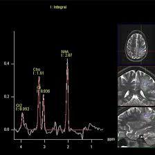 MRI Scan For MR Spectroscopy With Contrast | Medifyhome