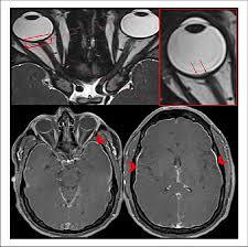 MRI Head With Orbit Starting at ₹3500 | Medifyhome