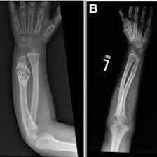 MRI Scan For Left Forearm | Medifyhome