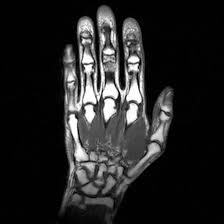 MRI Screening Of Hand | Medifyhome
