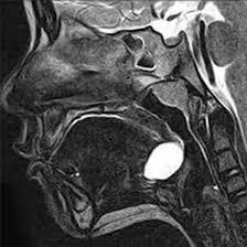MRI for Thyroid Plain | At best prices | Medifyhome