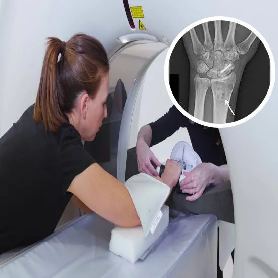 NCCT Right Hand | Medifyhome