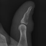 NCCT Thumb | Starts from 4000 | Medifyhome