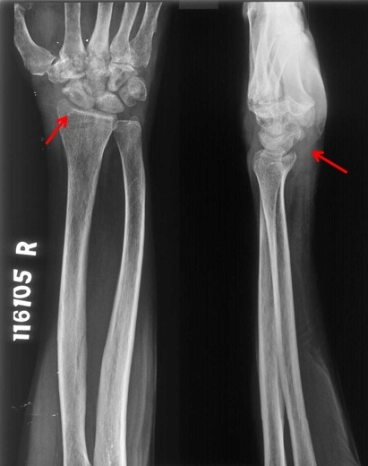 NCCT Wrist Joint | Starts from ₹3,000 | Medifyhome