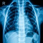 MRI Screening Of Chest | Medifyhome