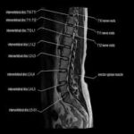 CECT Dorsal Spine | Medifyhome