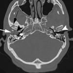 CECT Face and Neck | Medifyhome
