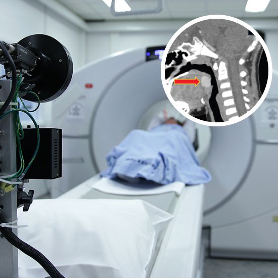 CECT Neck Scan | Medifyhome