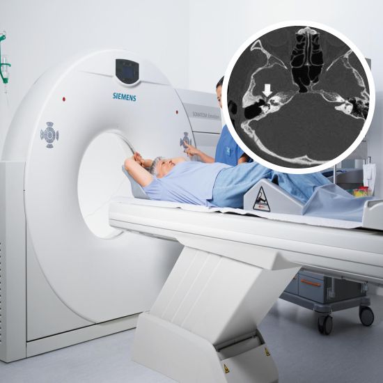 HRCT Temporal Bone (Axial & Coronal) | Medifyhome