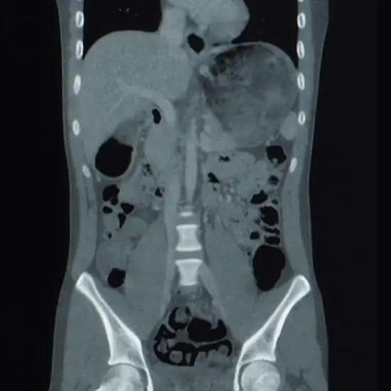 CECT Upper Abdomen | Medifyhome